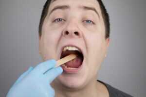 Is Tonsillitis Contagious?