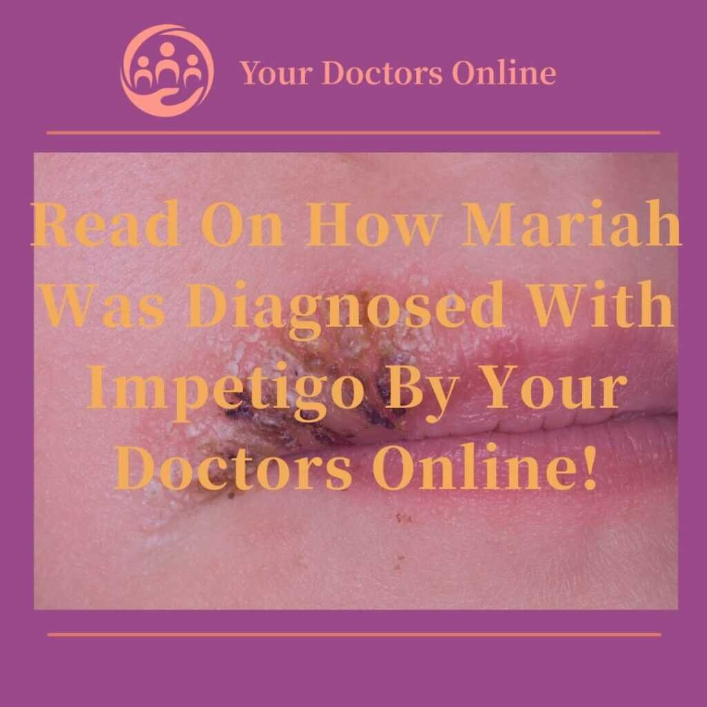 Read On How Mariah Was Diagnosed With Impetigo By Your Doctors Online!